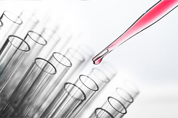 5S Principles in Laboratory Management | BradyID.com